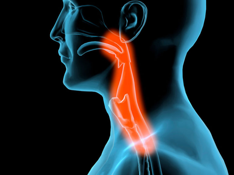 Laryngitis Comprehensive ENT Laryngitis Comprehensive ENT